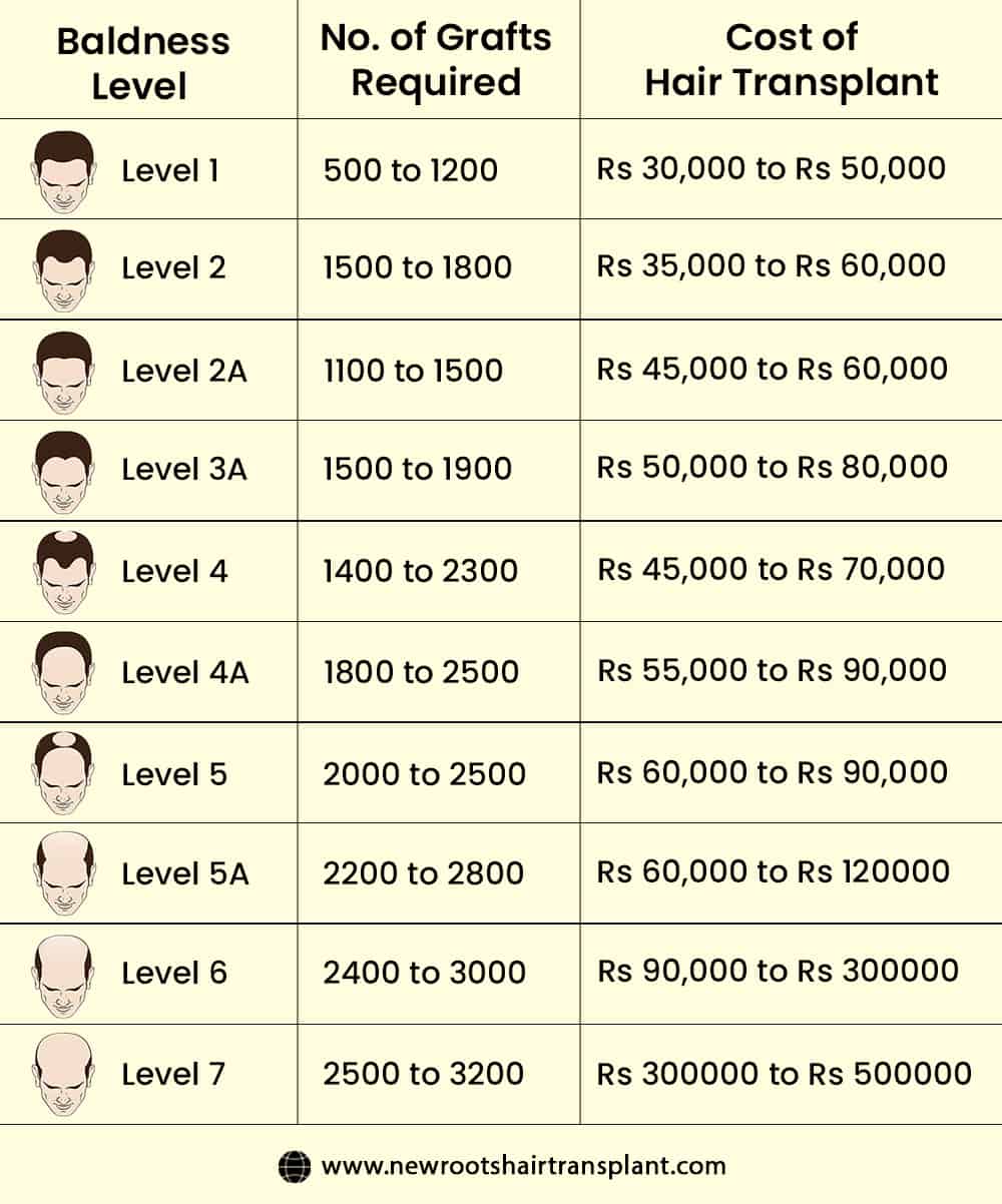 Hair Transplant Cost In India Get The Best Price For 2023